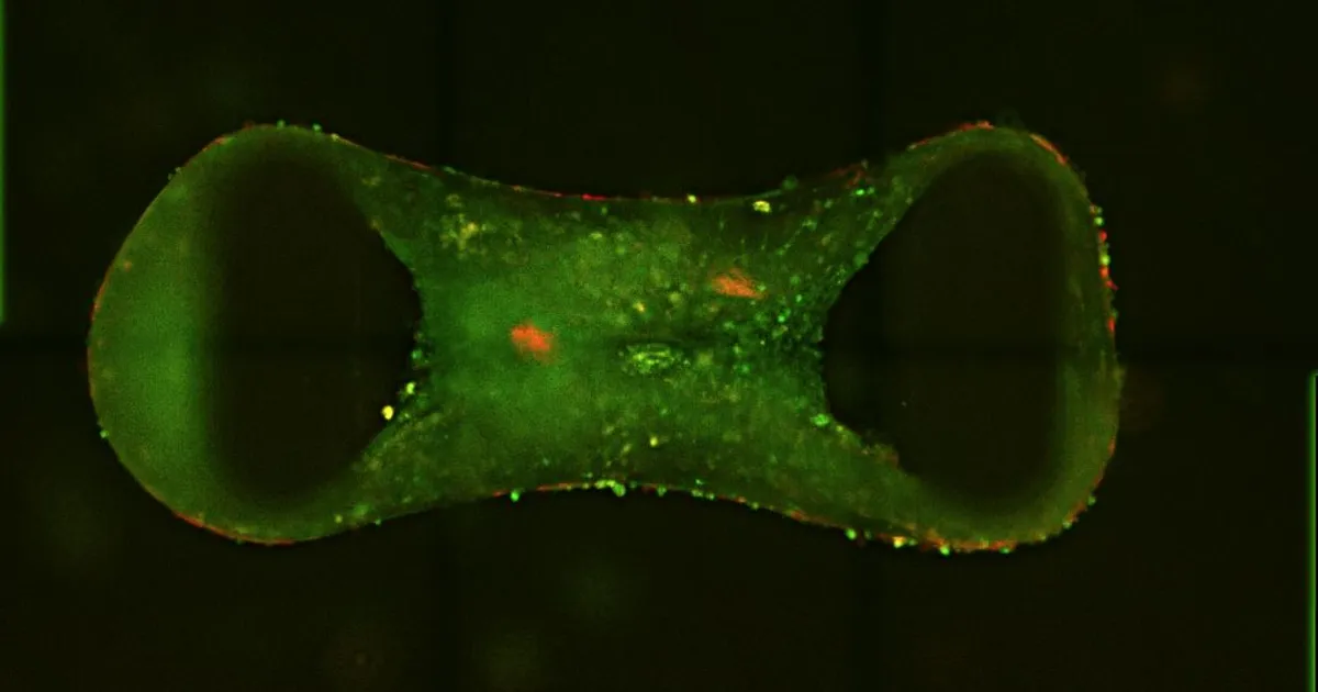 Lab-grown ‘tiny hearts’ bring hope for children and adults with genetic ...